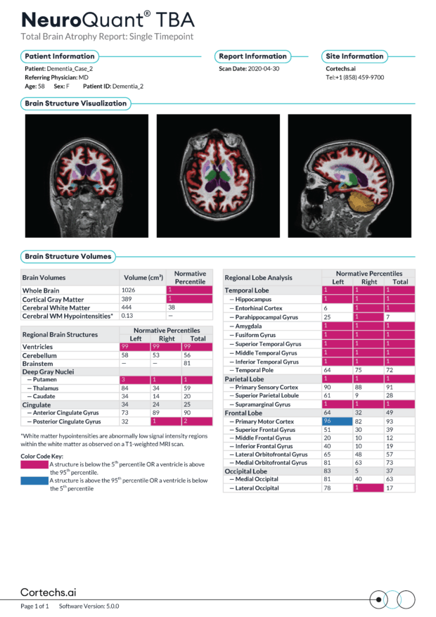 Brain MRI with NeuroQuant® Procedure | Rezilir Health
